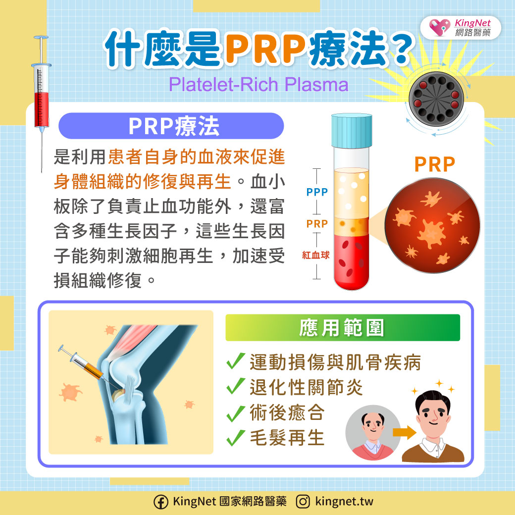 什麼是PRP療法？-KingNet國家網路醫藥